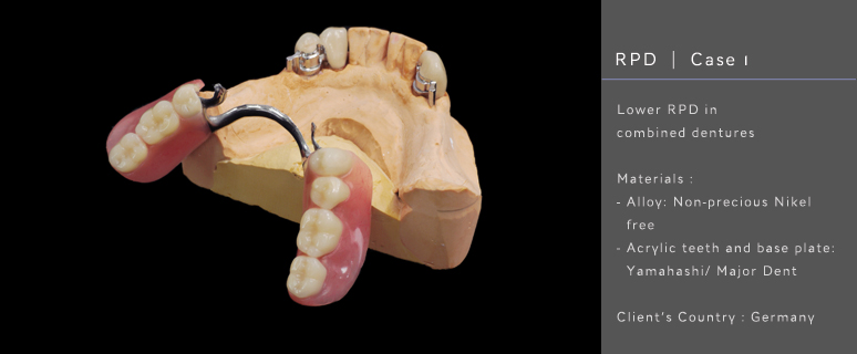 KDental-CO-CR PARTIAL DENTURE