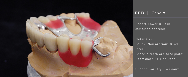 KDental-CO-CR PARTIAL DENTURE