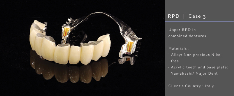 KDental-CO-CR PARTIAL DENTURE